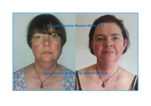 Zone Face Lift « Calmblue Holistic Therapies